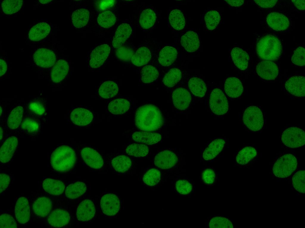 8049 - Anti-MuSK IFA