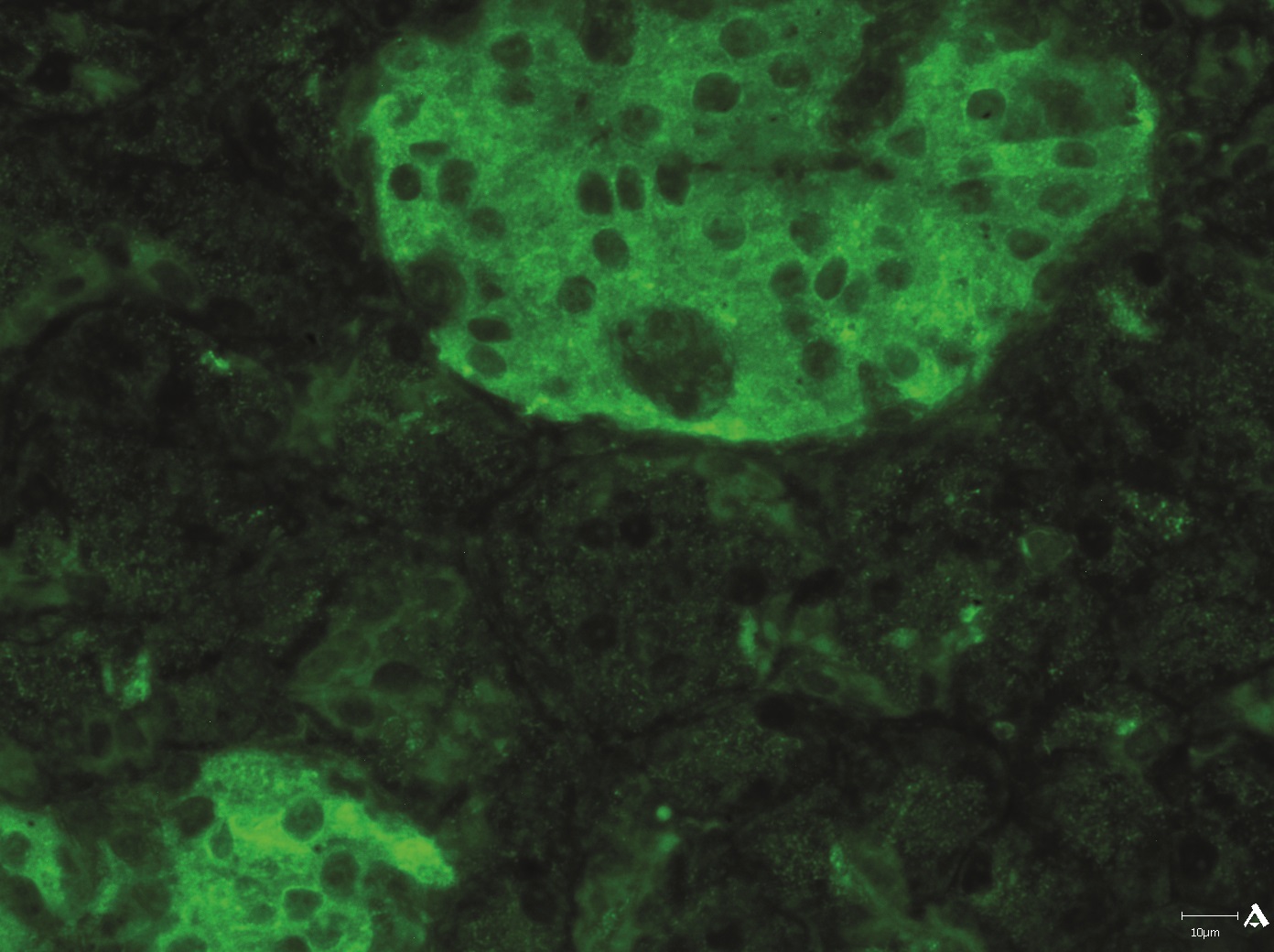 85848 - ICA IFA - Medipan & GA Generic Assays