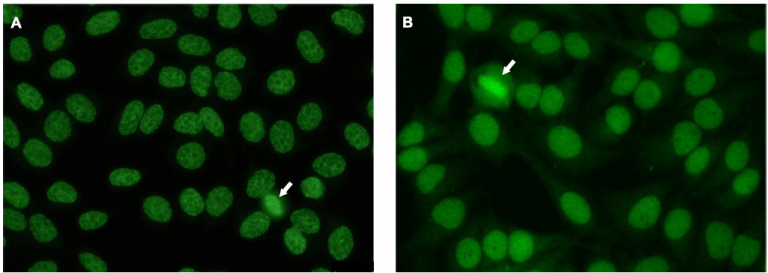 ICAP update of ANA Pattern Classification