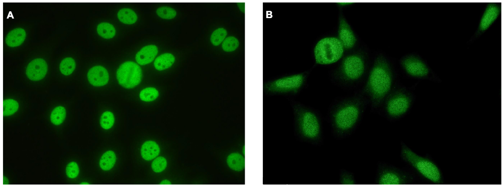 ICAP update of ANA Pattern Classification