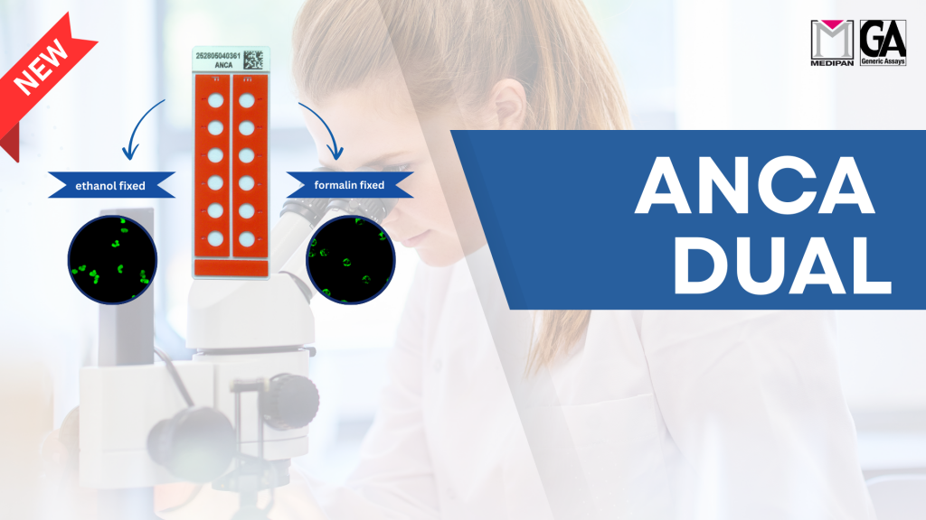 ICAP-Update: Erweiterung der ANA-Musterklassifikation mit AC-30 und AC ...